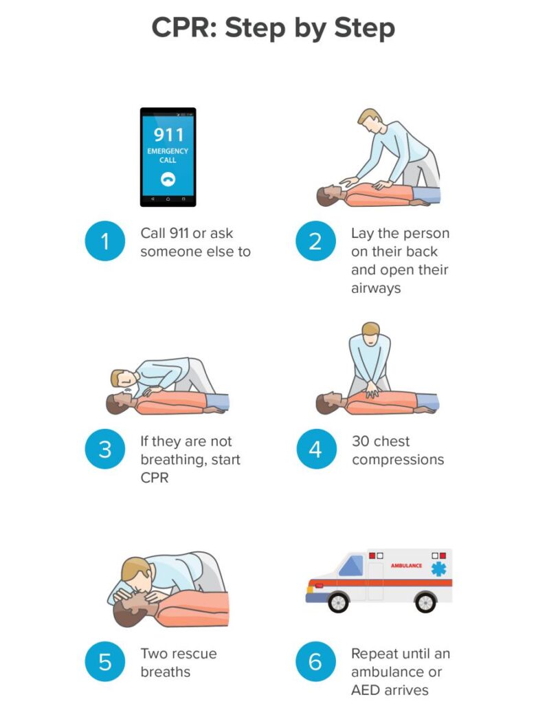 How to Perform CPR Basic Guide